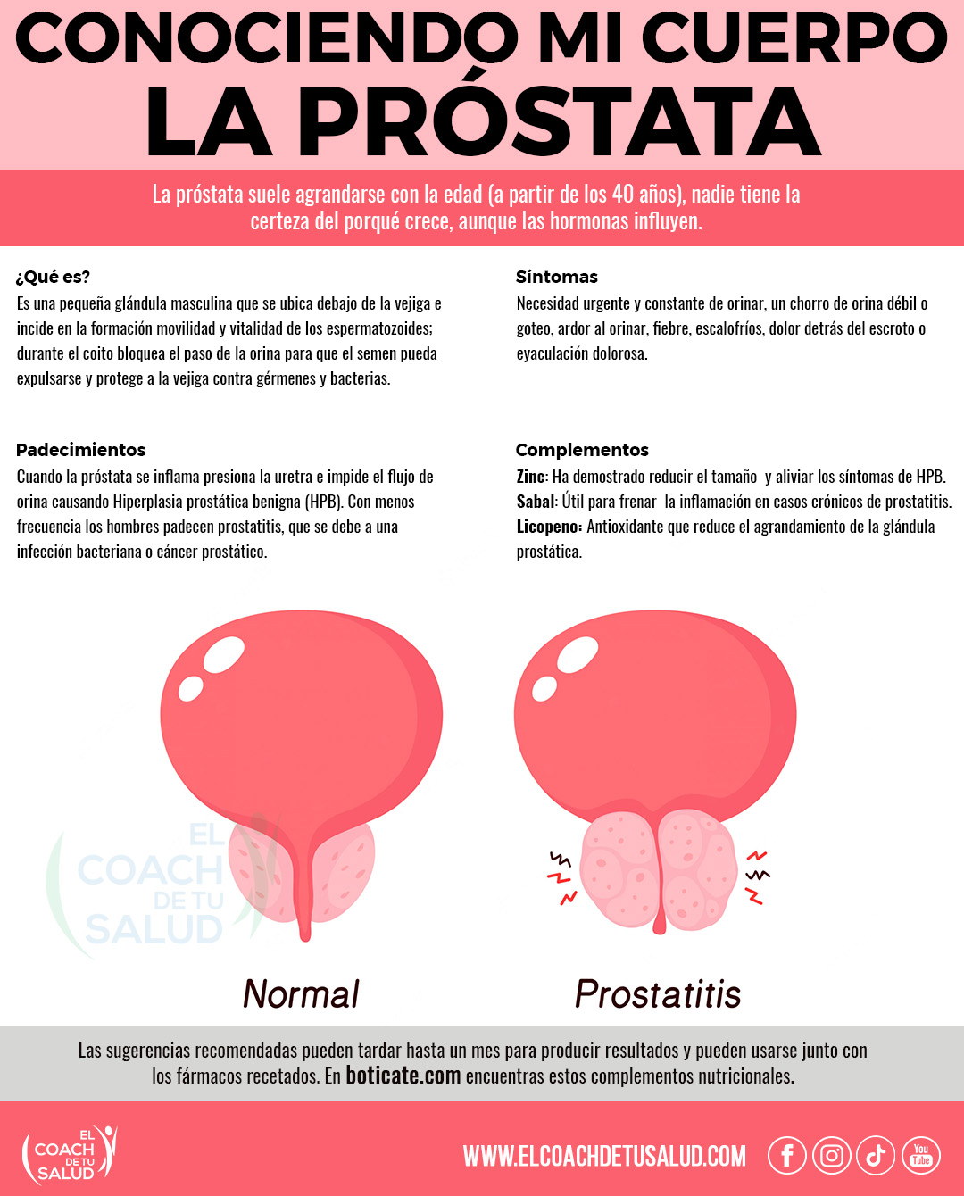 Trata la Prostatitis de manera natural – El Coach de tu Salud