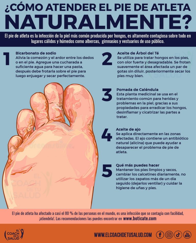 Pie de atleta y su tratamiento natural – El Coach de tu Salud